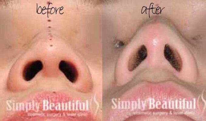 Dr Peter Kim Surgery - Skin Cancer, Cosmetic & Laser Clinic
