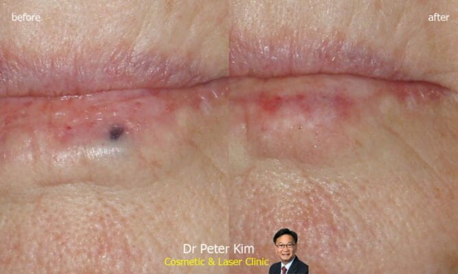 Dr Peter Kim Surgery - Skin Cancer, Cosmetic & Laser Clinic